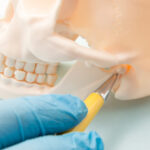 What is gnathology? - Everything you need to know about gnathology ...